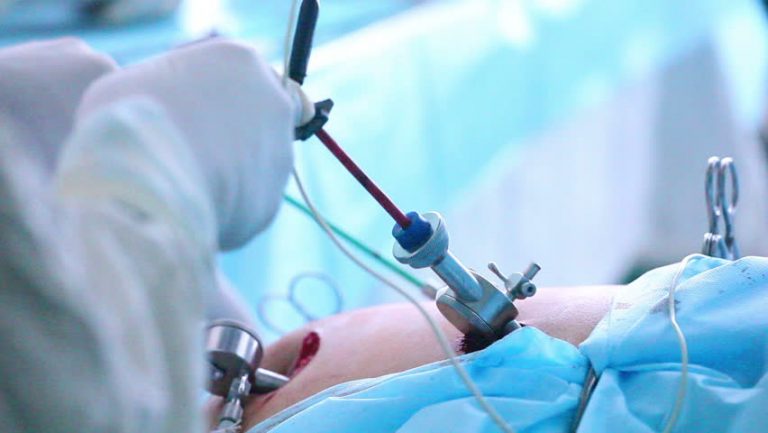 Common Types of Laparoscopic Surgery - Best General Surgeons NYC
